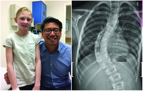 Clubs reach across the Atlantic to help girl | Rotary International