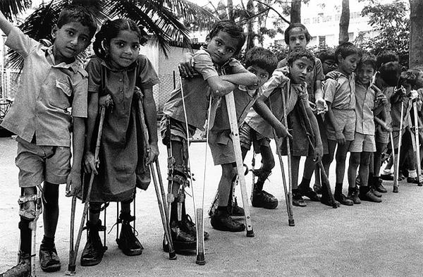 Partners In Eradicating Polio Timeline Rotary International